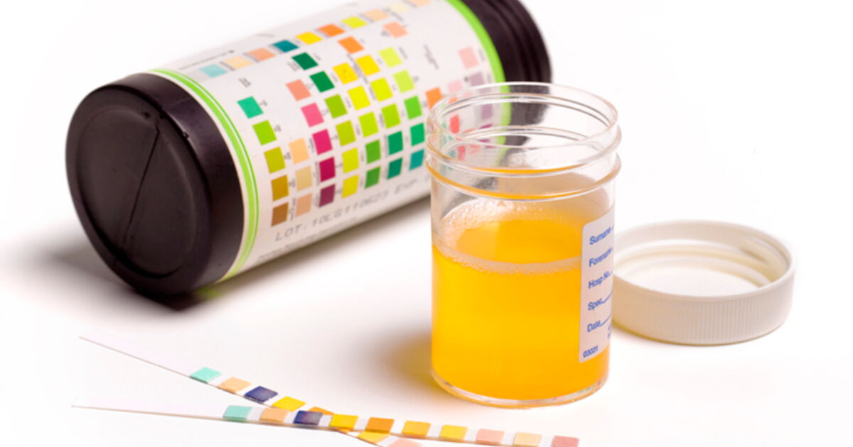 Pourquoi a-t-on du sang dans les urines ? - Ça m'intéresse