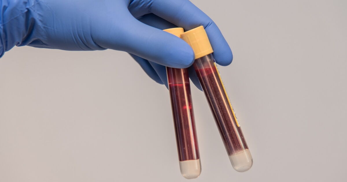 Sang : est-ce dangereux d'avoir trop de fer ? - Ça m'intéresse